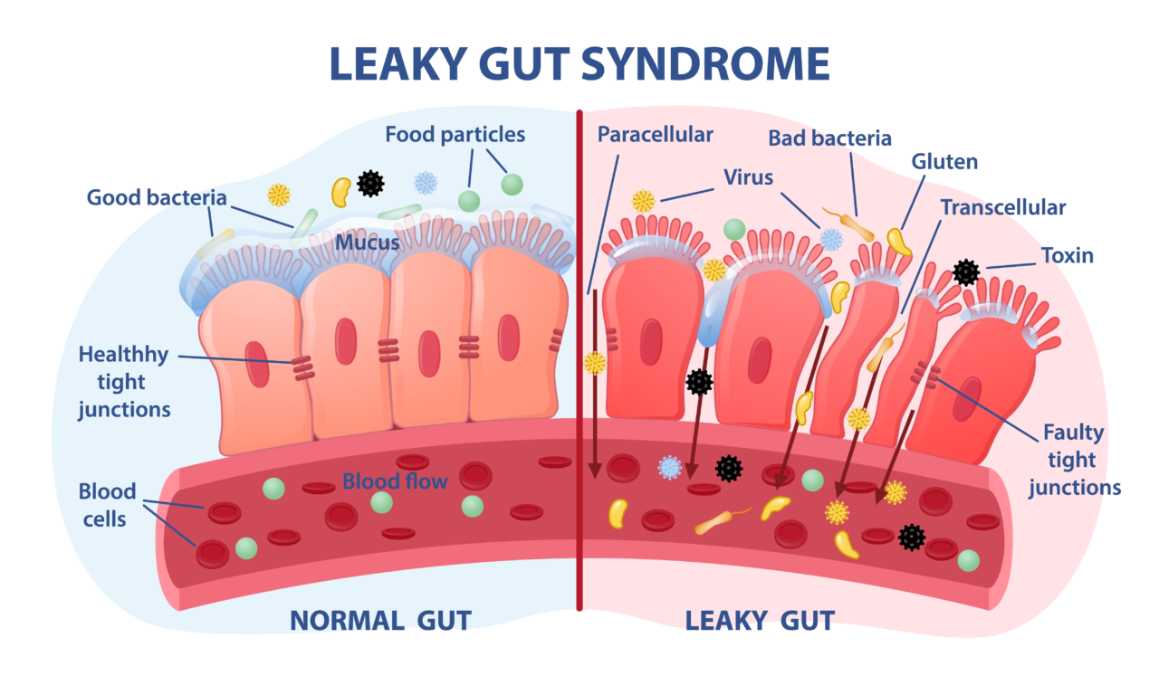 Education - Gut Health Nurse